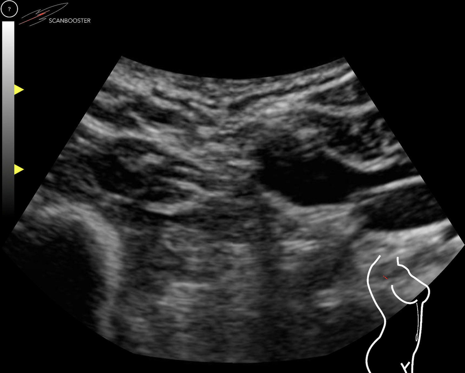 Welcome to Scanbooster, the world's first realistic Ultrasound ...