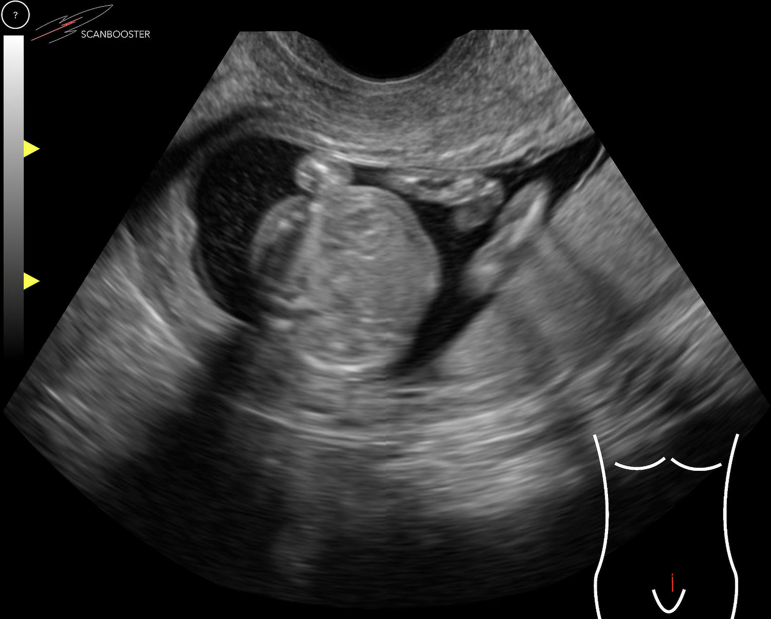 Welcome to Scanbooster, the world's first realistic Ultrasound ...
