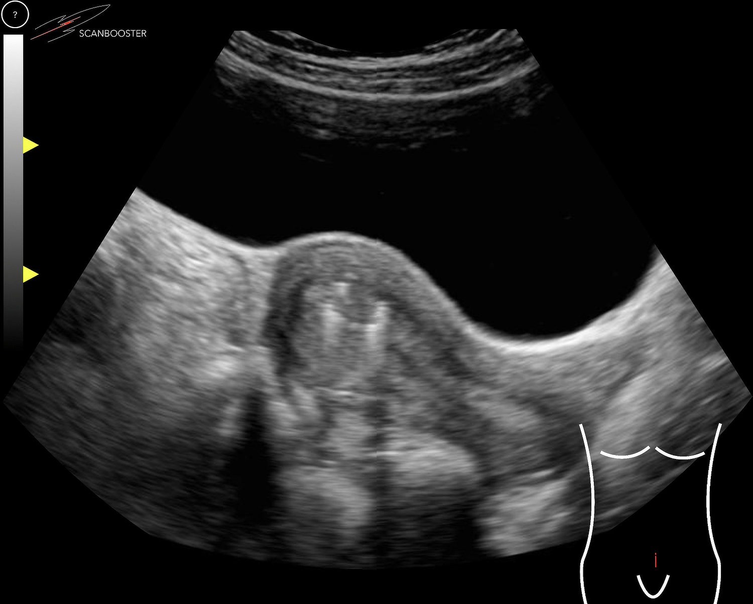 Welcome to Scanbooster, the world's first realistic Ultrasound ...
