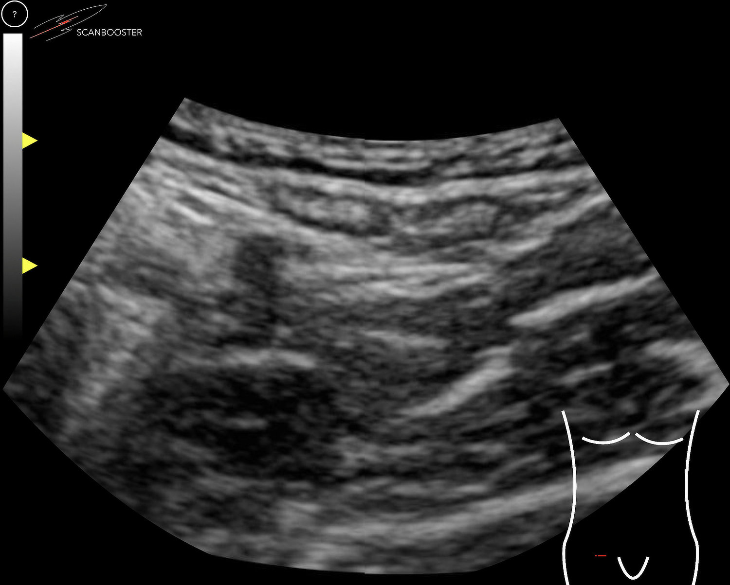 Welcome to Scanbooster, the world's first realistic Ultrasound ...